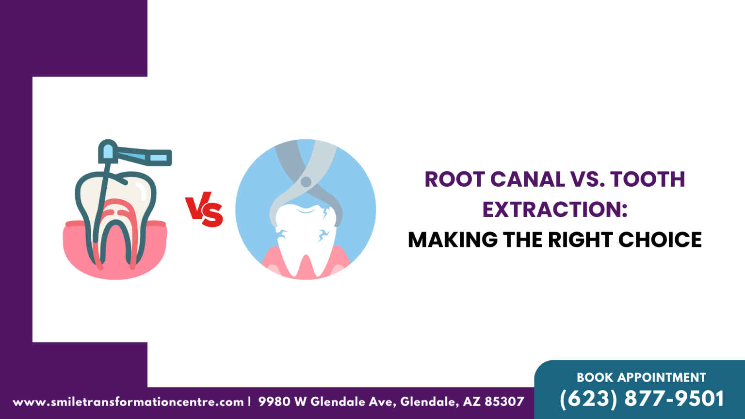 Root Canal vs Tooth Extraction : Making the Right Choice