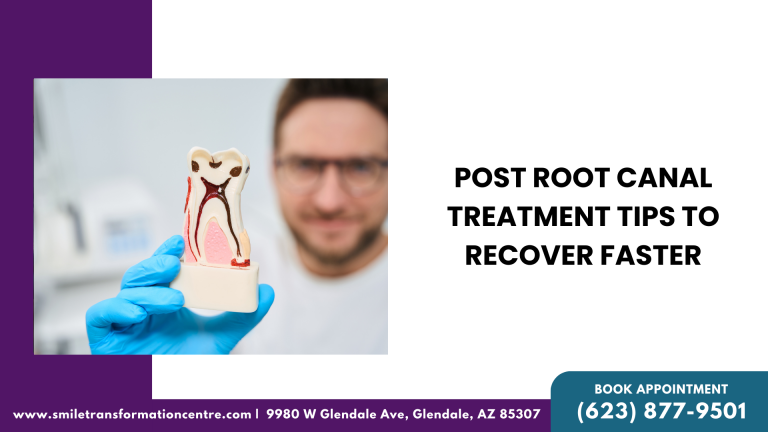 Post Root Canal Treatment Tips To Recover Faster